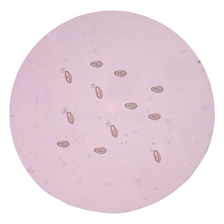 Eggs of parasite stock image. Image of white, tick, ticks - 90275313
