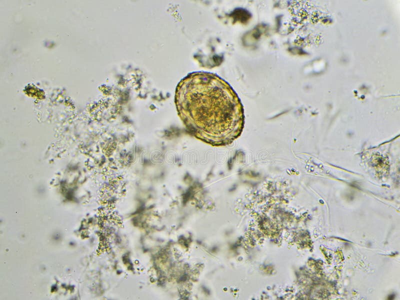 Ei Von Ascarid Lumbricoides Spulwurm Stockbild - Bild von rückstände ...