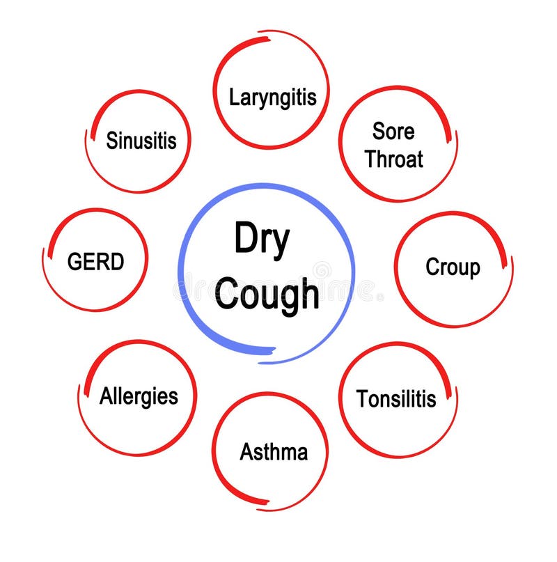 Causes of Dry Cough stock illustration. Illustration of sore - 284154062