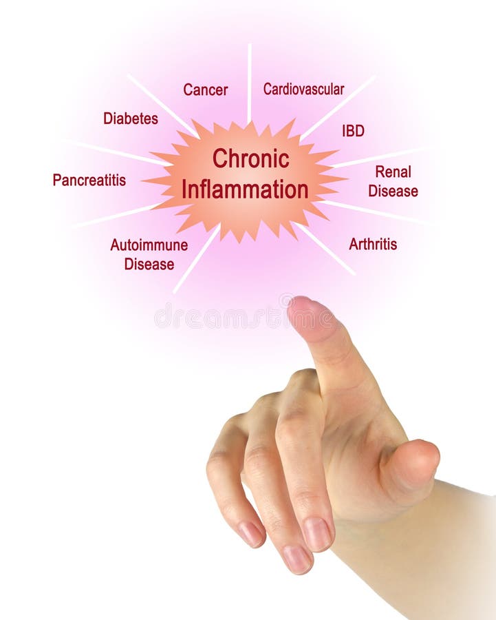 Consequences of Chronic Inflammation Stock Image - Image of person ...