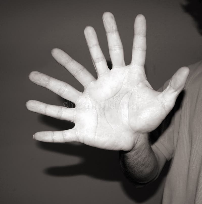 Eight finger hand stock photo. Image of hand, fingers, mutant - 4740