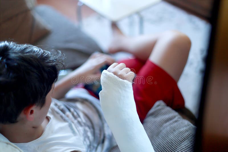 Ein gebrochener Arm stockbild. Bild von unfall, krankenhaus - 95077229