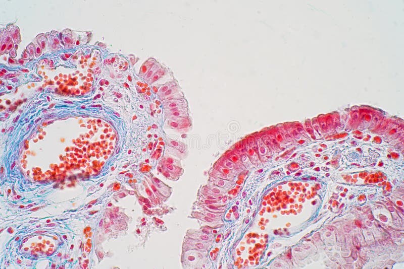 Einfaches Zylinderepithel Ist Ein Zylinderepithel, Das Uni- Ist ...