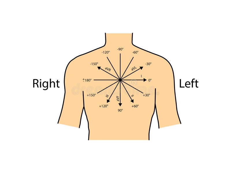 Einthoven ECG Triangle, Including Augmented Unipolar Limb Lead Stock ...