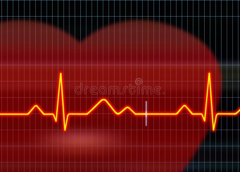 Ejemplo Del Cardiograma Imagen. Imagen: 5497324