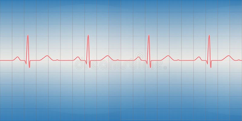 Ejemplo Del Cardiograma Imagen. Imagen: 5497324