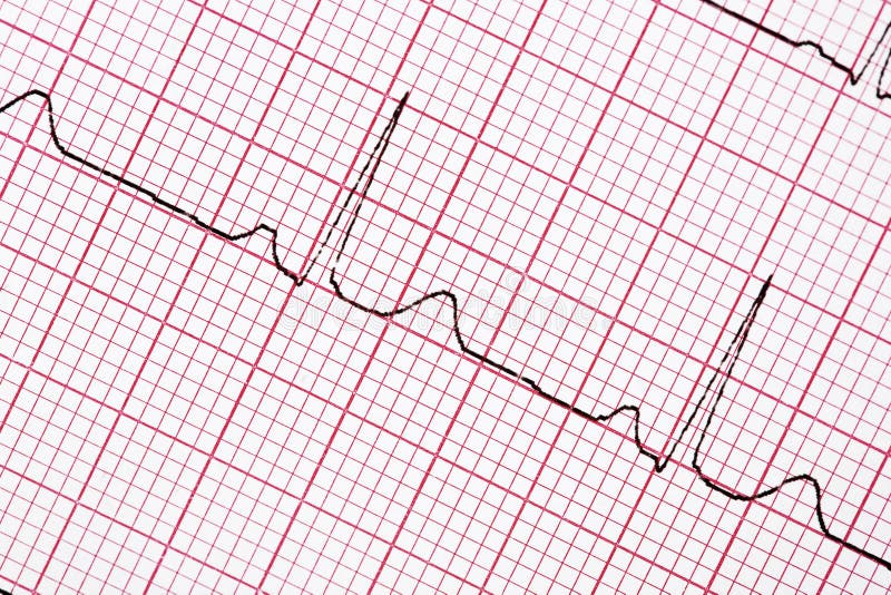 EKG stock image. Image of chart, illness, printout, scrutiny - 21303987
