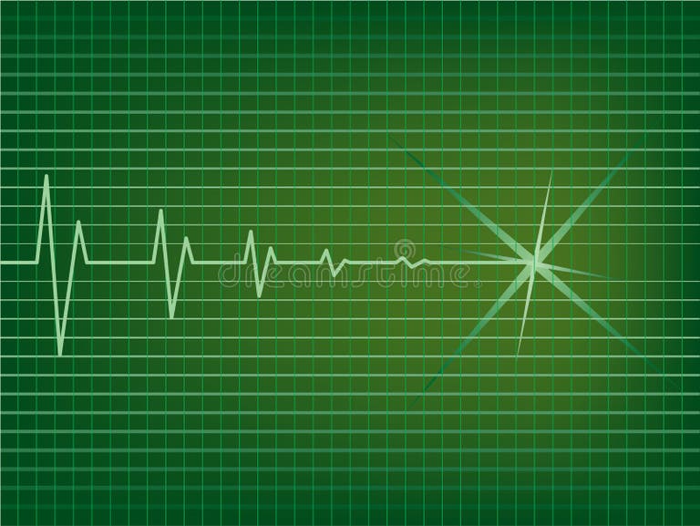 Ekg Wave Stock Illustrations – 13,152 Ekg Wave Stock Illustrations ...