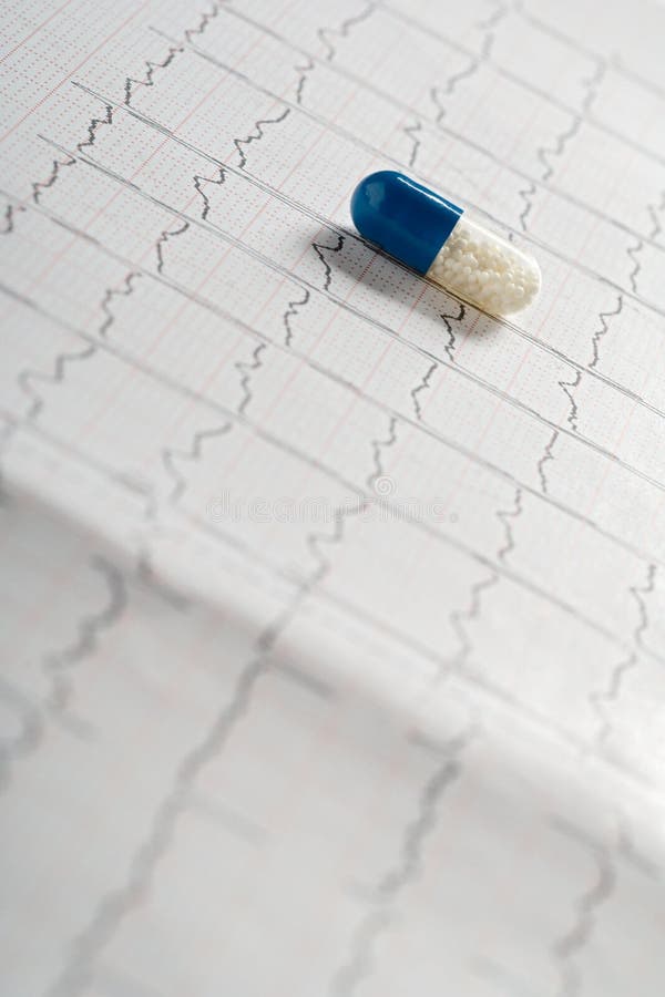 EKG stock photo. Image of doctor, hospital, coronary, healthcare - 3701454