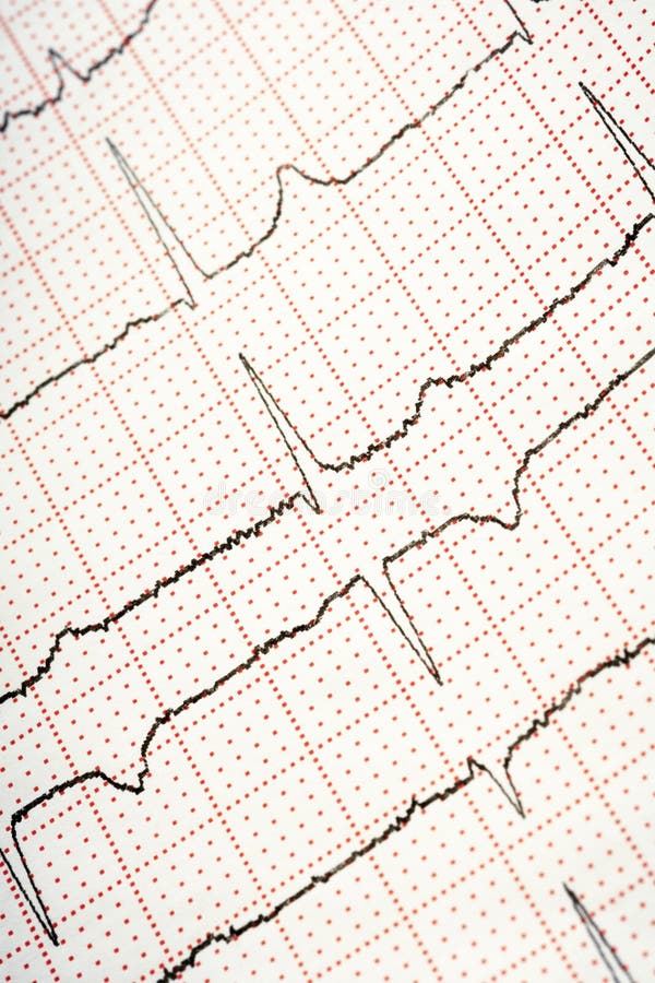 Ekg stock image. Image of condition, health, heart, checkup - 4118215