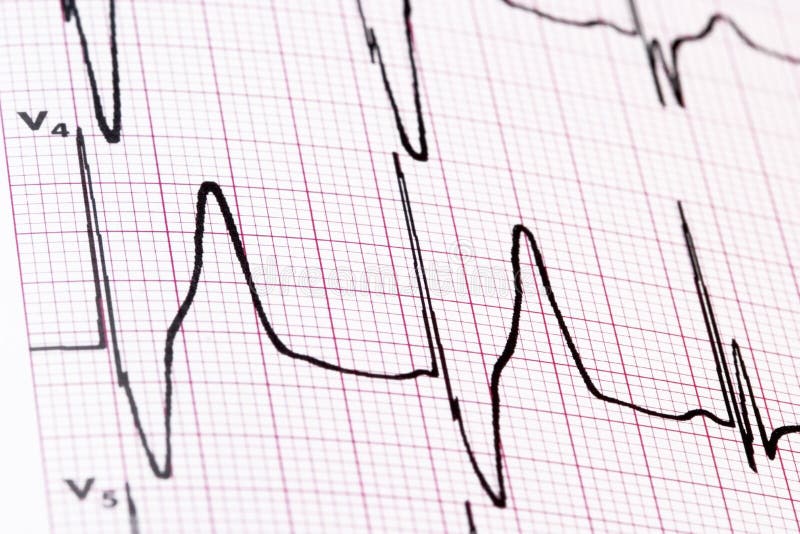 Ekg stock image. Image of electrical, cardio, shape, graph - 4630603