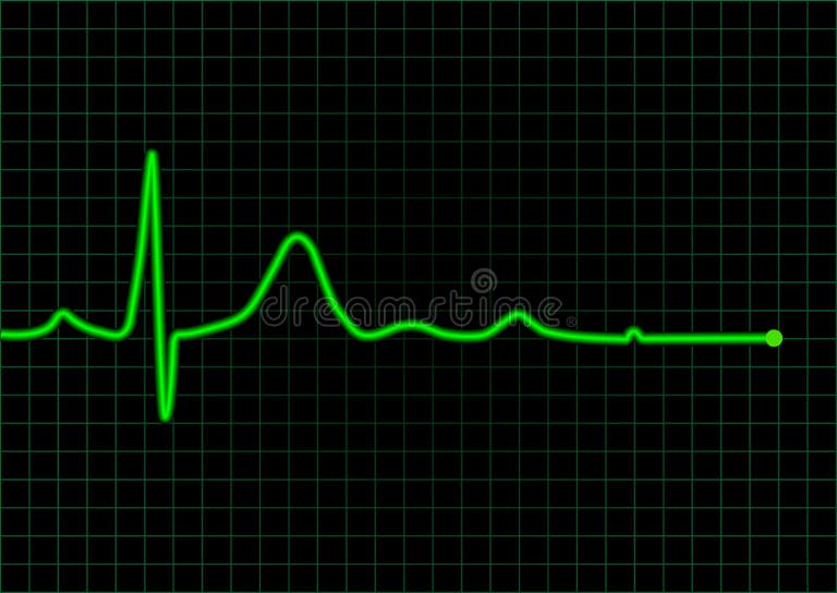 Ekg Death Stock Illustrations – 1,150 Ekg Death Stock Illustrations ...