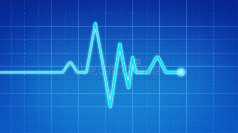 Dynamic Ekg Stock Illustrations – 566 Dynamic Ekg Stock Illustrations ...