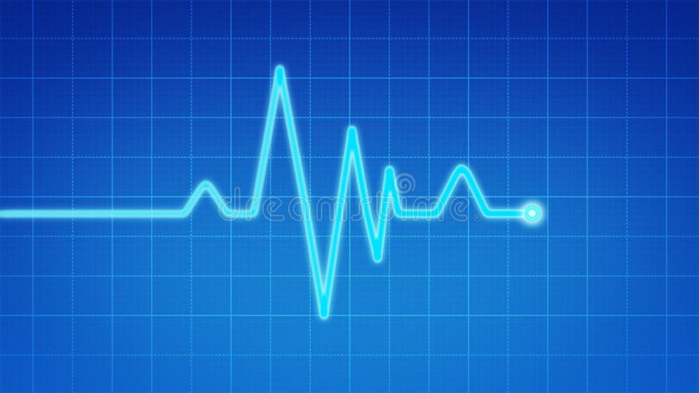 Ekg Pattern Stock Illustrations – 1,861 Ekg Pattern Stock Illustrations ...