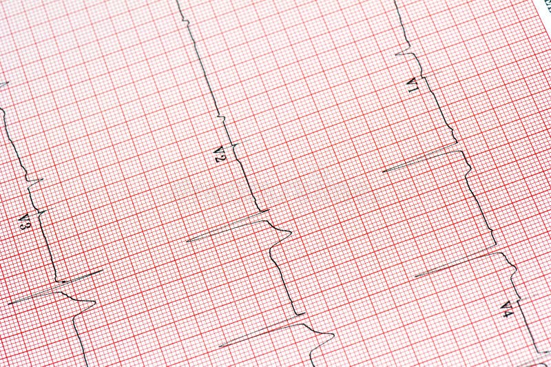 EKG background stock photo. Image of graphic, disease - 17751258