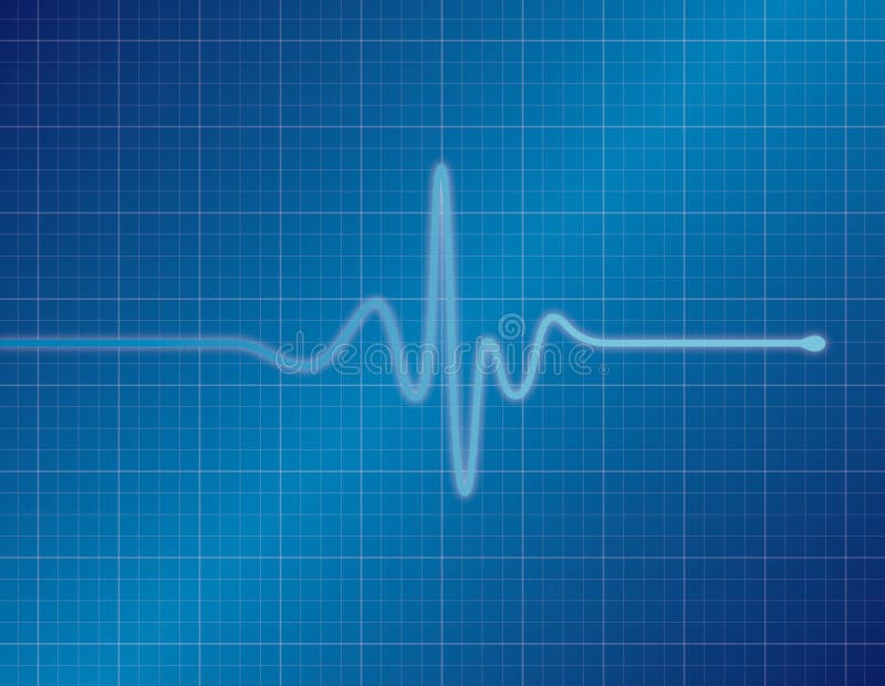 EKG - Blue stock vector. Illustration of graph, vitality - 4072780