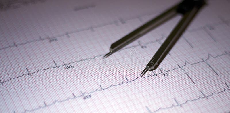 Electrocardiogram, or EKG, with Calipers Stock Image - Image of graph ...