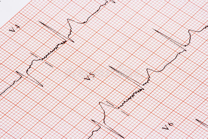 EKG chart stock image. Image of heart, digital, signal - 3638013