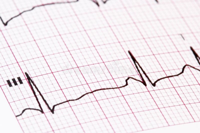 Ekg/ ecg as a background stock photo. Image of activity - 5643886