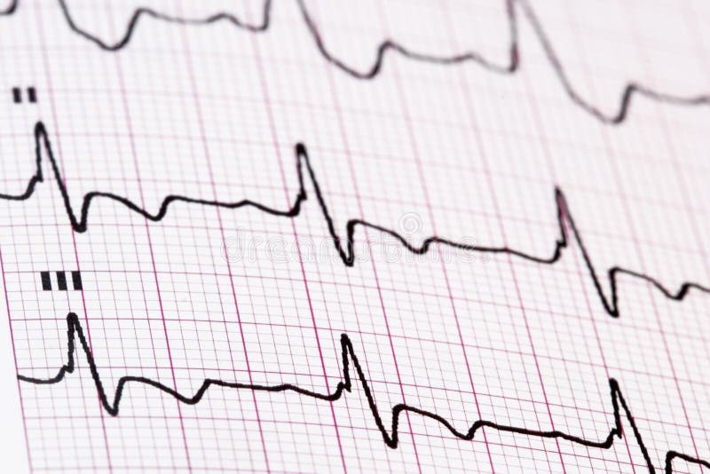 Ekg/ ecg as a background stock photo. Image of pulse, shape - 5644090