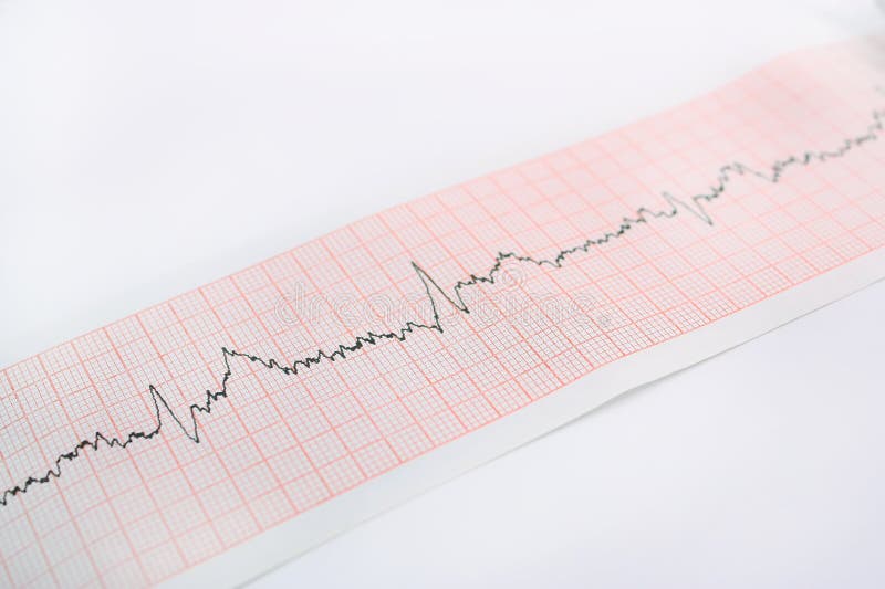 EKG or ECG Graph. Electrocardiogram Examination. Close Up Stock Image ...