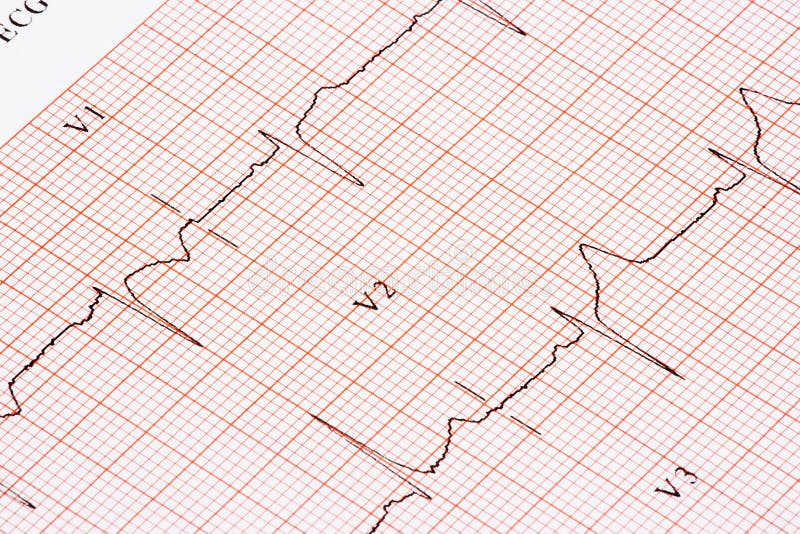 EKG printout stock image. Image of heart, range, health - 9732861
