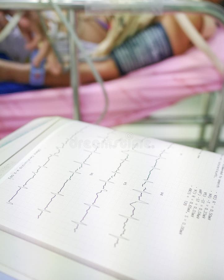 Ecg Printing Stock Photos - Free & Royalty-Free Stock Photos from ...