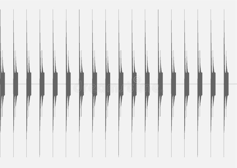 Royalty-Free EKG Medical Unit Beep Signal with Heart Beat Loop Stock ...