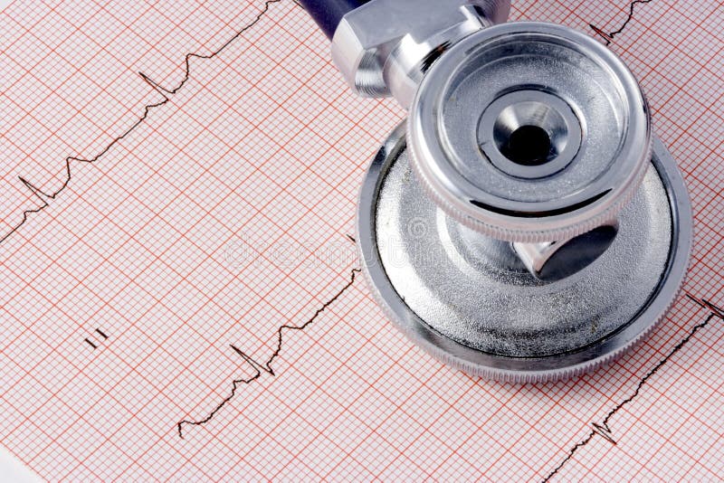 EKG and stethoscope stock photo. Image of graph, signal - 4283988