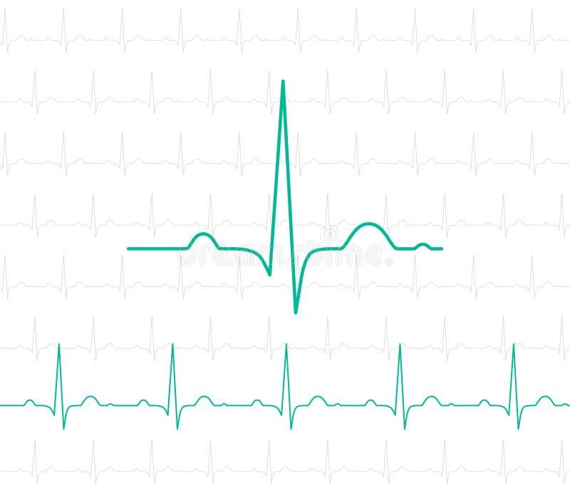 Ecg White Background