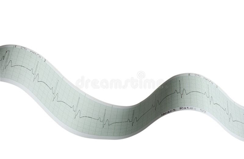 EKG Tape Electrocardiograph (with Clipping Path) Stock Photo - Image of ...
