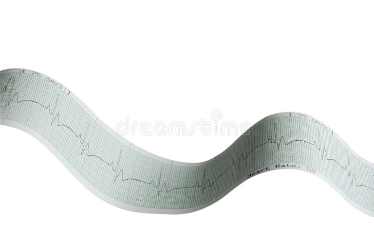 EKG Tape Electrocardiograph (with Clipping Path) Stock Photo - Image of ...