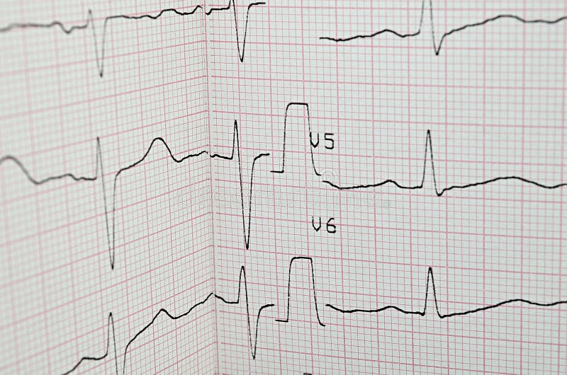 EKG test stock image. Image of checkup, background, draw - 64337251