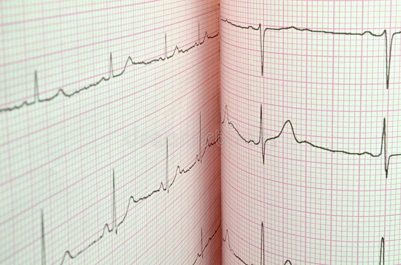 EKG test stock photo. Image of diagnose, electro, cardiovascular - 64337282