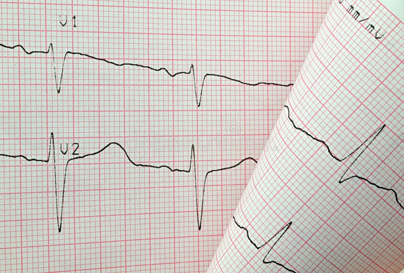 EKG test stock photo. Image of heart, diagnostic, blood - 64337292