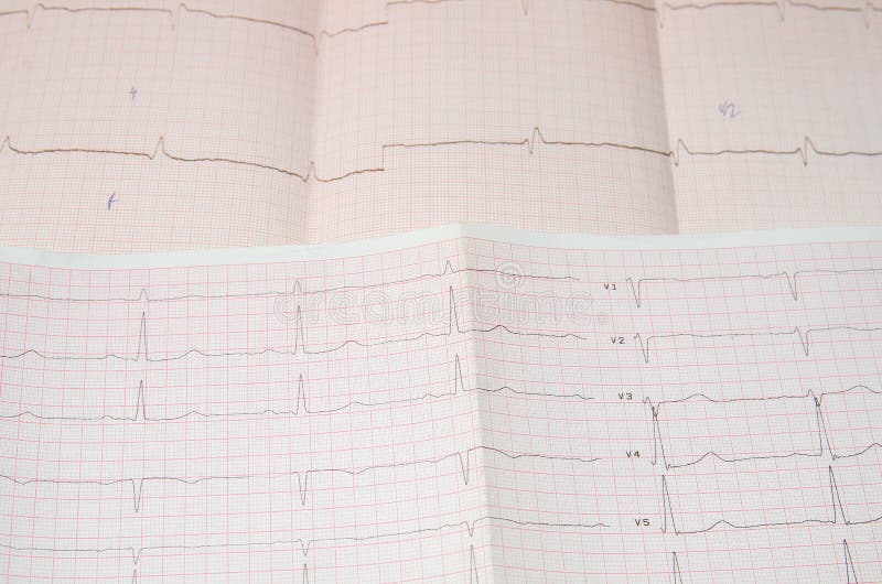El cardiograma imagen de archivo. Imagen de golpe, vida - 63788289