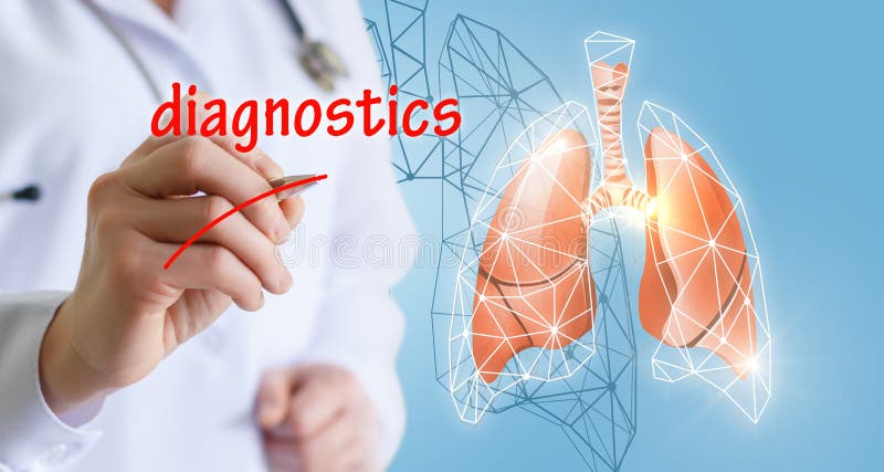 El Doctor Diagnostica Los Pulmones Humanos Imagen de archivo - Imagen ...