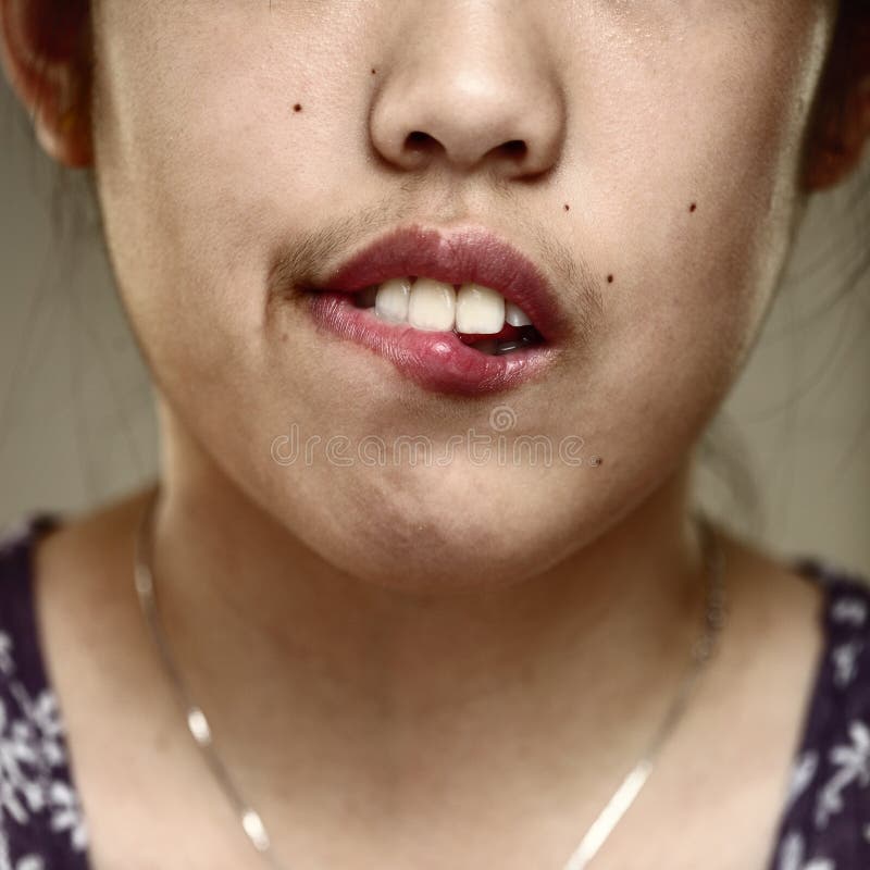 El morder del labio imagen de archivo. Imagen de preocupado - 23271357