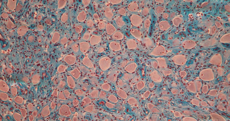 El Paladar Hendido Plexiformes Almacen De Video - Vídeo de movimiento ...