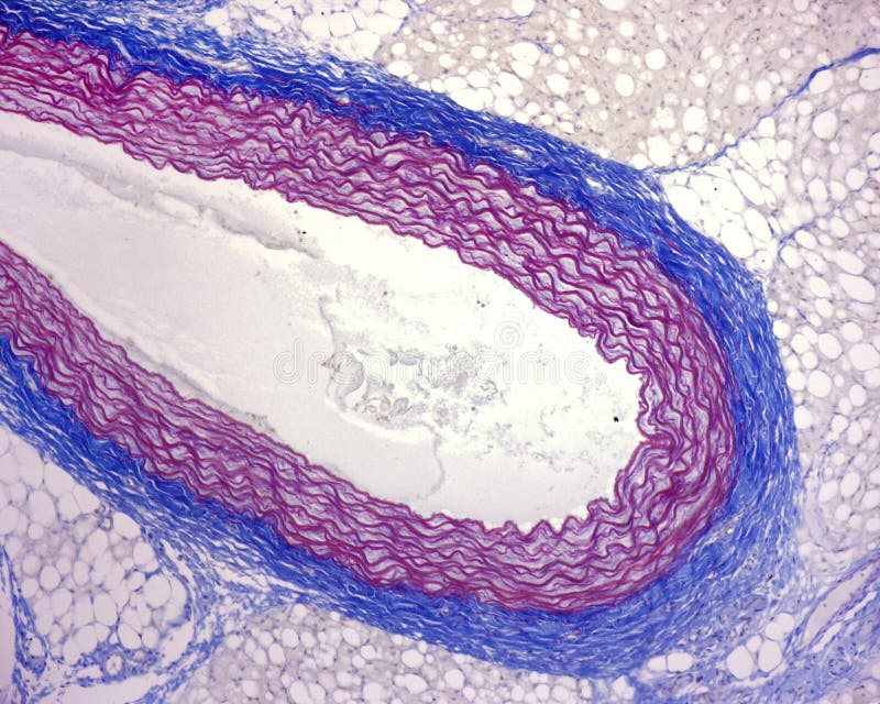 Elastic artery stock image. Image of micrograph, elastic - 324197911