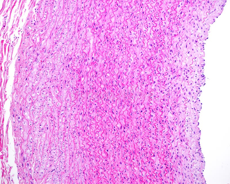 Elastic Artery. Tunica Media Stock Image - Image of system, blood ...