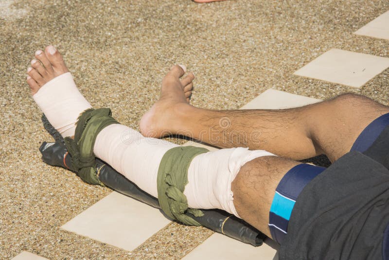 Elastic Bandage Apply Pressure Immobilized Technique or PIT Wind Stock ...