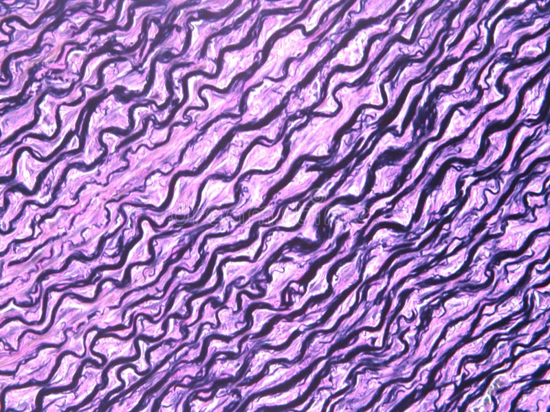 Elastisch Die Weefsel Door Een Microscoop Wordt Gezien Stock Afbeelding ...