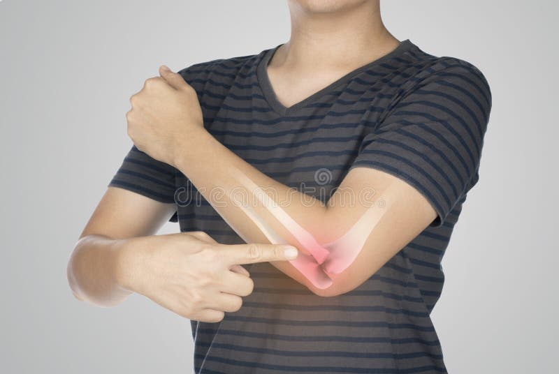 Elbow bones injury stock photo. Image of extensor, bone - 218196598