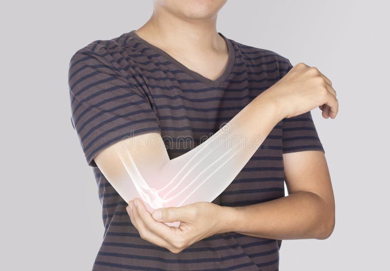 Elbow bones injury stock photo. Image of motion, bone - 217004596