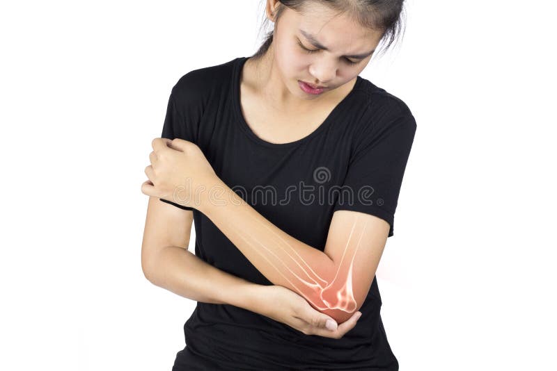 Elbow bones injury stock image. Image of bones, disease - 144478581
