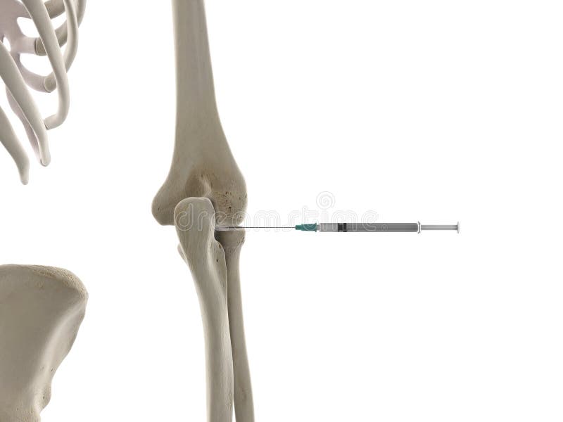 An elbow injection stock illustration. Illustration of rendering ...