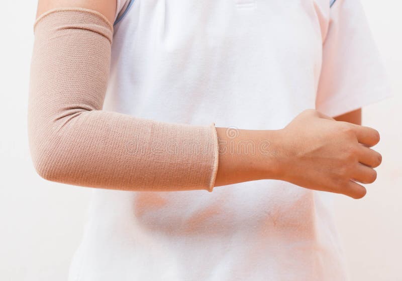 Elbow injuries. stock image. Image of cast, sore, pain - 67354317