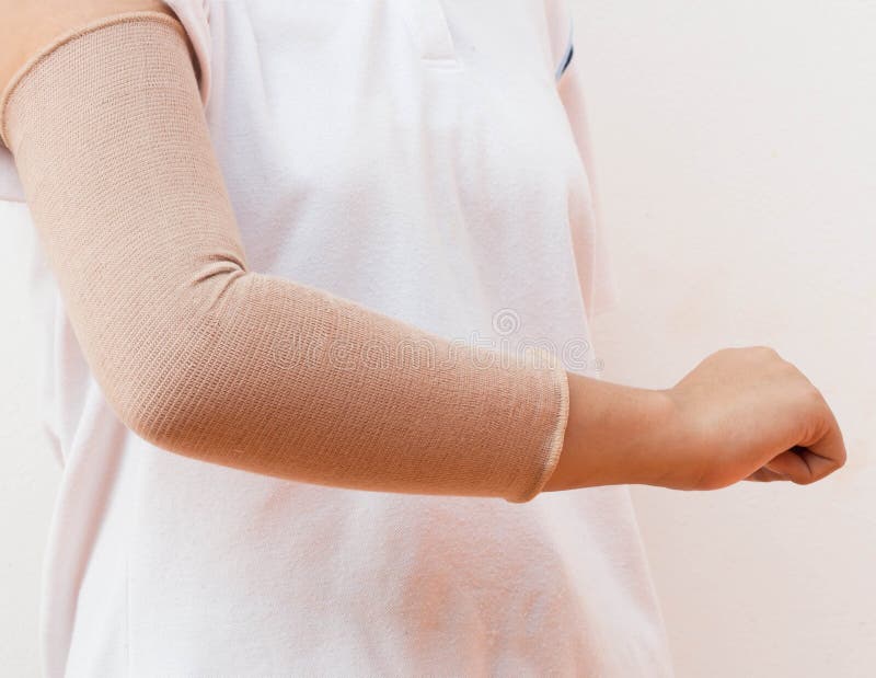 Elbow injuries. stock image. Image of bone, life, still - 67354363