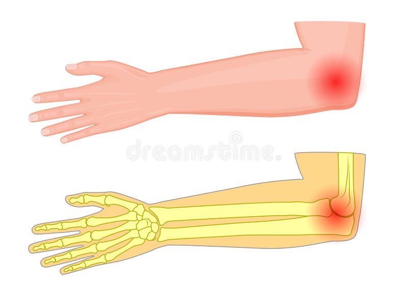 The Elbow Joint stock illustration. Illustration of chiropractic - 36404981